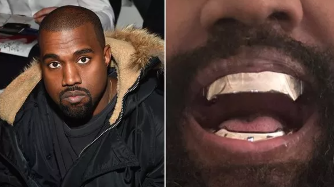 North West Shows Off Diamond Grills After Kanye West Reveals His $850k ...